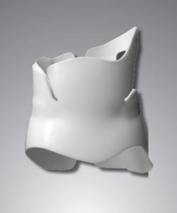 Custom Scoliosis Brace – Optec USA