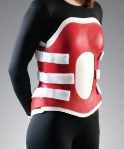 Custom SALO TLSO – Optec USA