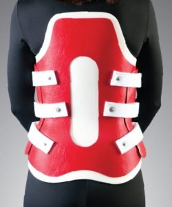 Custom SALO TLSO – Optec USA