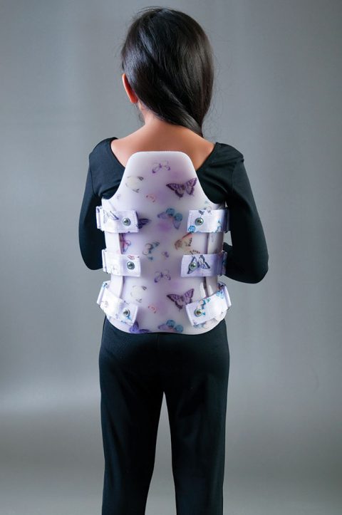 Custom TLSO Bivalve – Optec USA